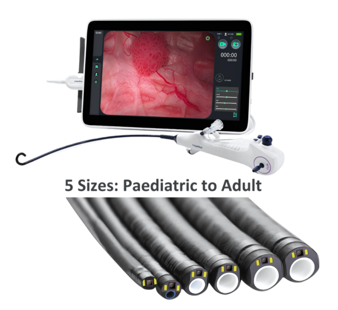 HugeMed Single Use Flexible Bronchoscope – Obex